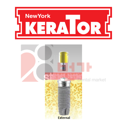 ★28번가★치과재료 전문 쇼핑몰 - Kerator Attachment (External)